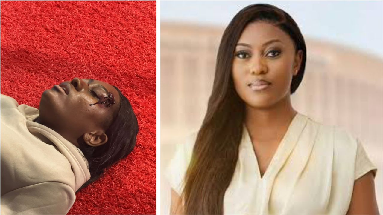 Faveur Mukoko explique enfin la photo d’elle blessée qui a ému la toile ...